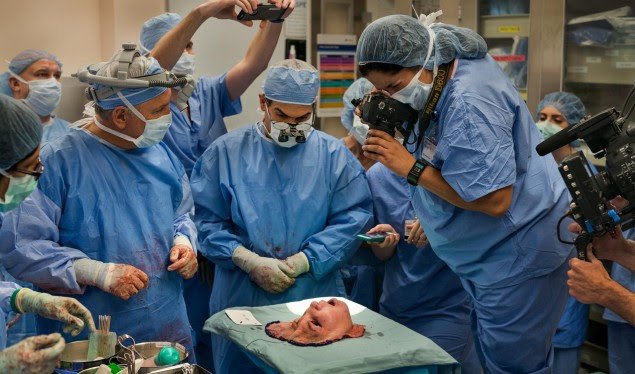 The story of the girl who became the youngest face transplant patient ...