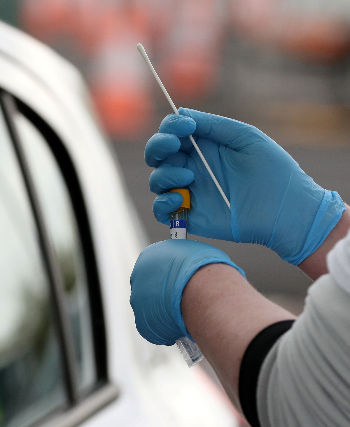 Σπυράκια, πονοκέφαλοι, μώλωπες: λιγότερο συχνά συμπτώματα του κορωνοϊού - KOHA.net